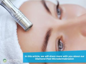 All about Diamond Peel Microdermabrasion